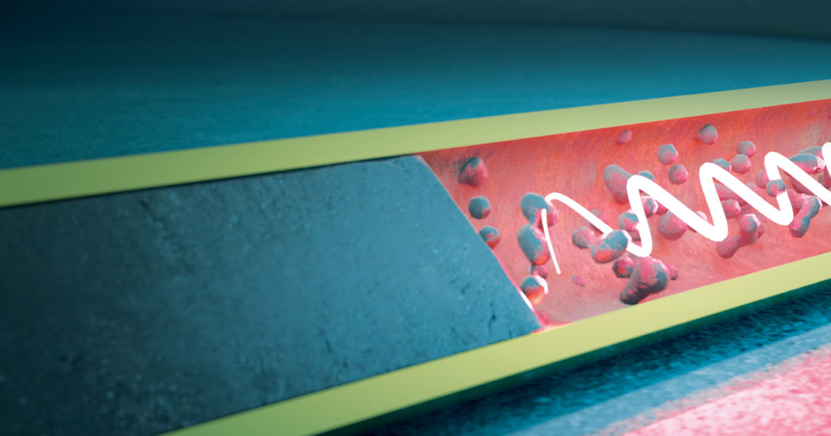 Pinpointing Blockages – Paradigm Group